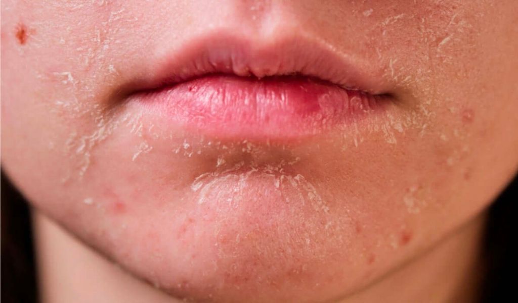 Lotion là gì? Công dụng và cách sử dụng hiệu quả cho mọi loại da