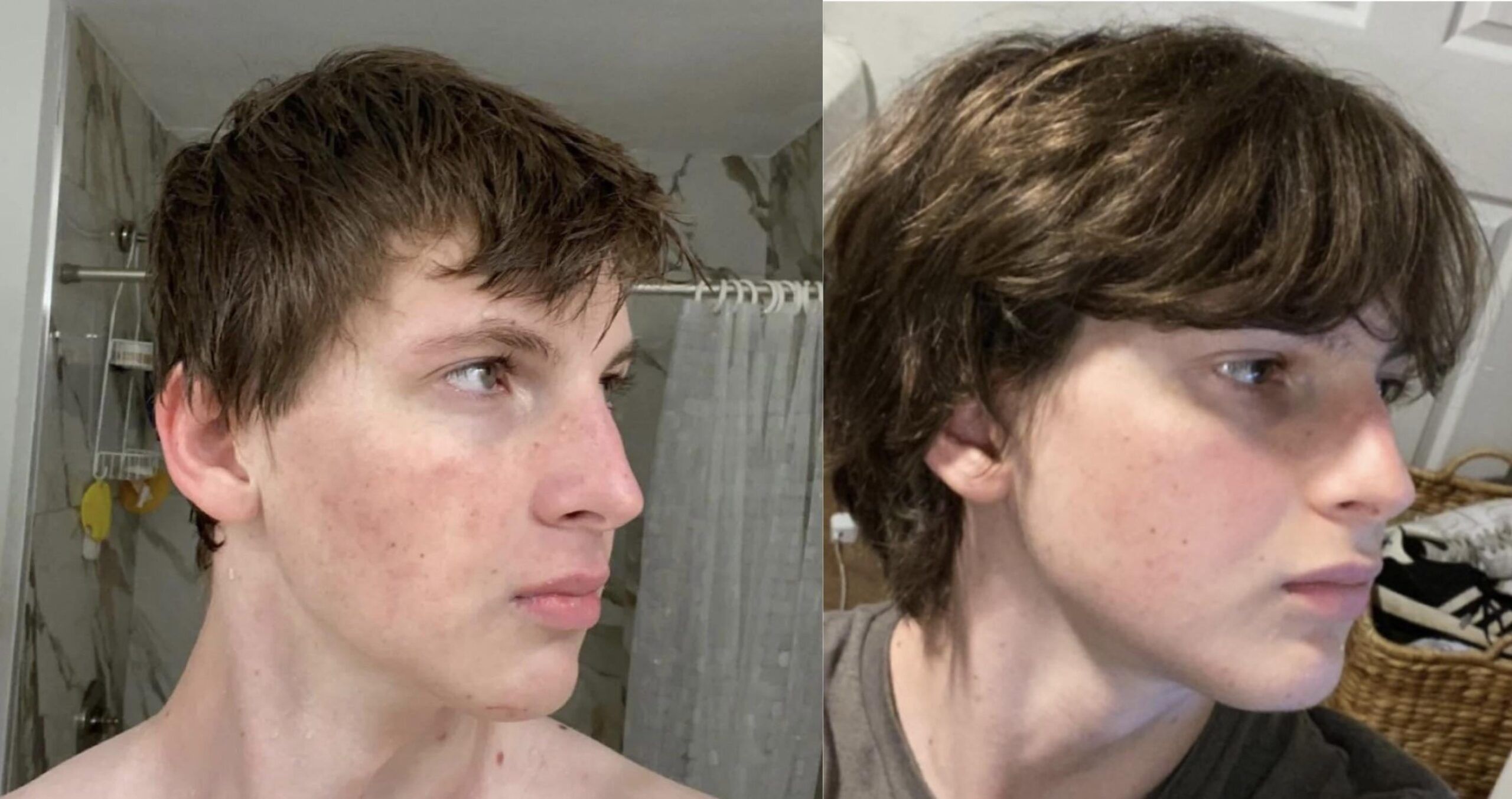 Hard mewing là gì? hướng dẫn luyện tập đúng cách để cải thiện khuôn mặt ...