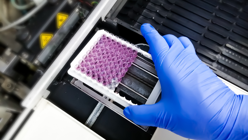 Lpa - line probe assay: phương pháp tiên tiến trong chẩn đoán bệnh ...