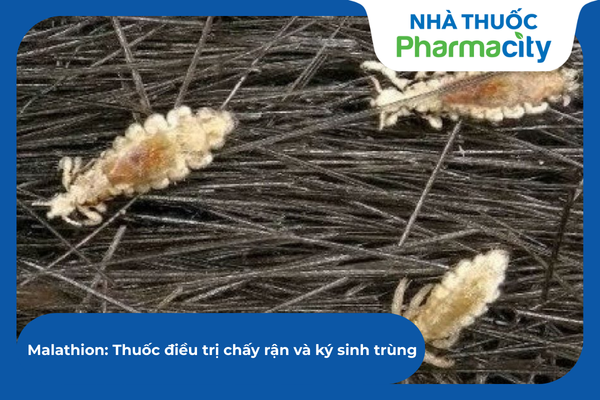 Malathion: Thuốc điều trị chấy rận và ký sinh trùng
