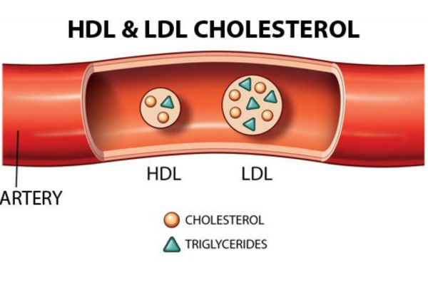 HDL cholesterol là gì? Bao nhiêu là bình thường và liên quan đến bệnh ...