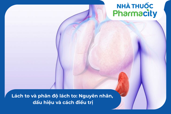 Lách to và phân độ lách to: Nguyên nhân, dấu hiệu và cách điều trị