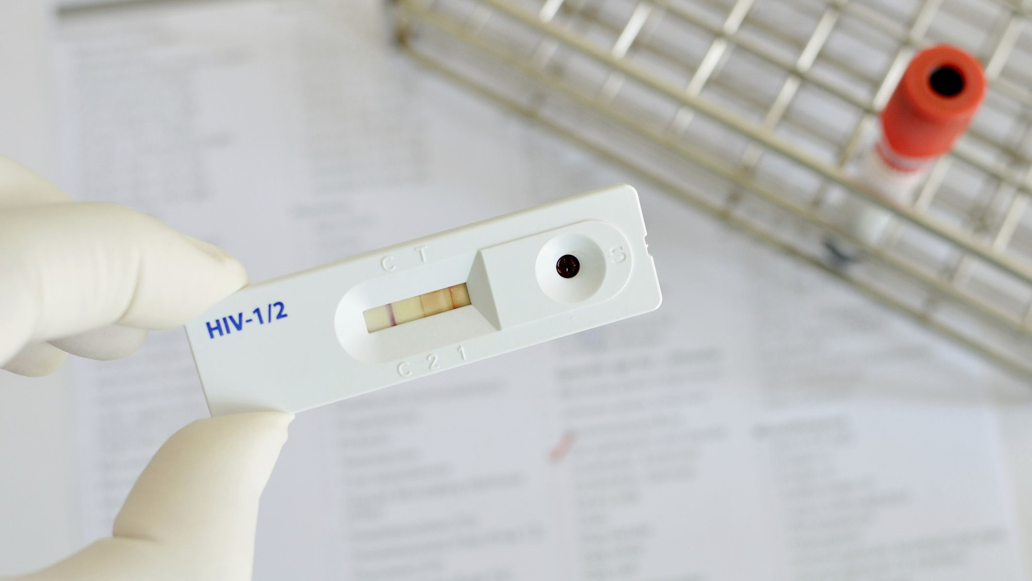 Hướng dẫn tự test hiv bằng que test tại nhà và thời điểm chính xác